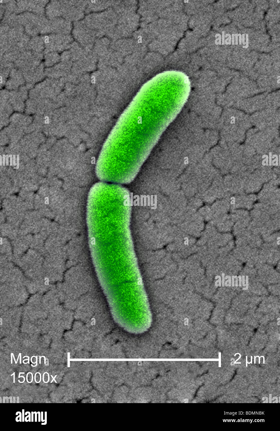 Scanning electron micrograph (SEM) of a single gram-negative Salmonella ...
