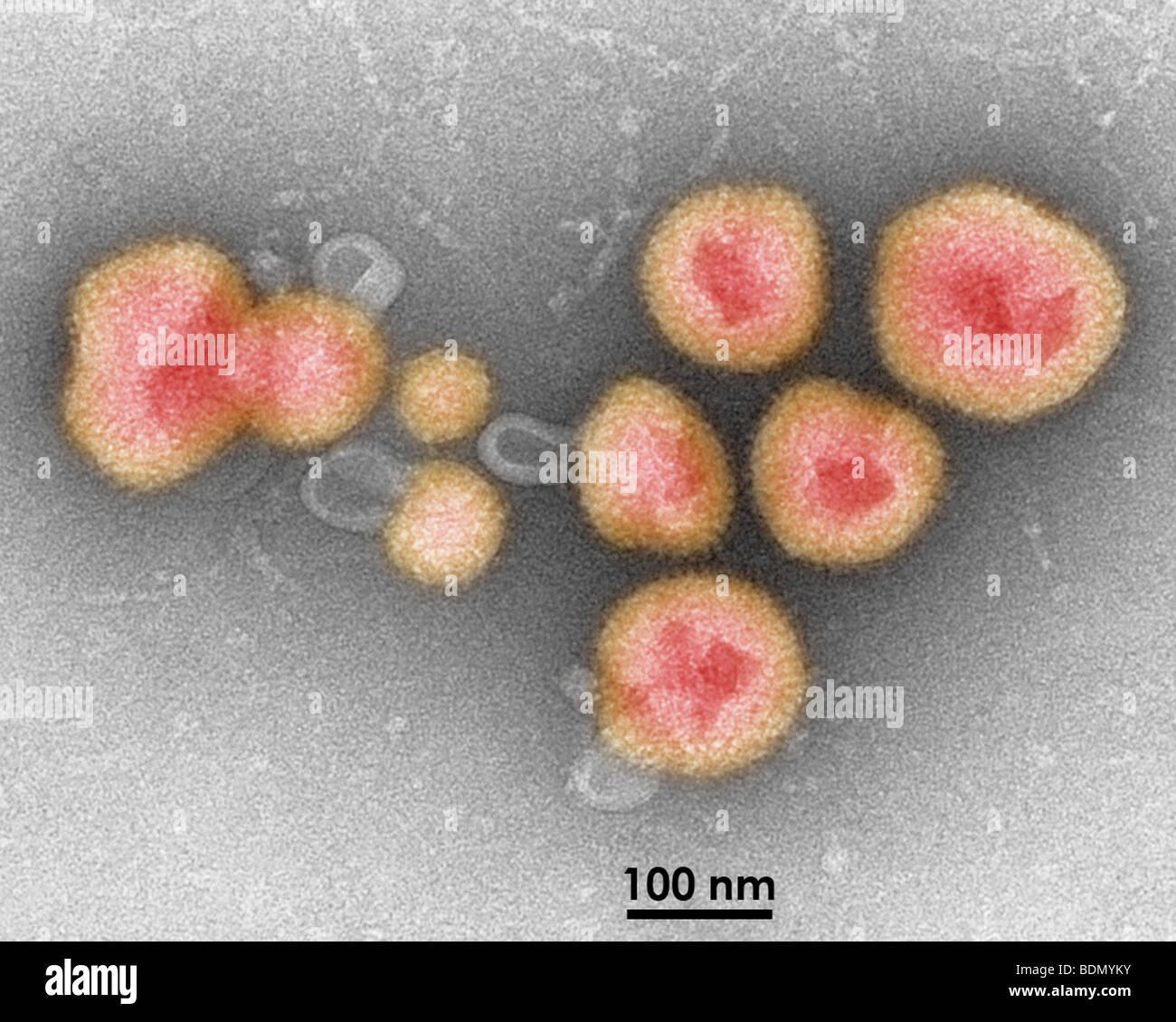 Transmission electron micrograph (TEM) of virions (viral particles) of ...