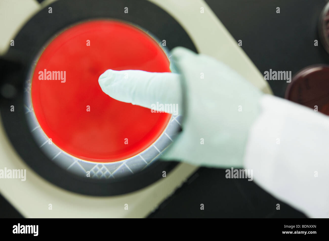 Scientist analyzing blood plate Stock Photo - Alamy