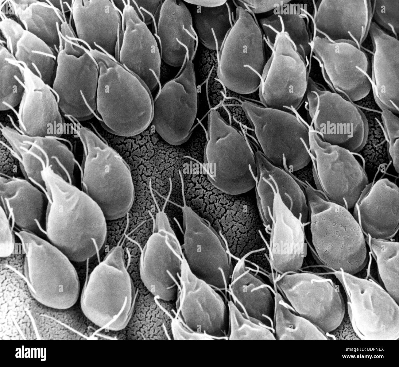 This scanning electron micrograph (SEM) shows the mucosal surface of ...