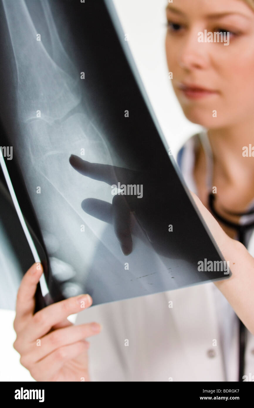 A female doctor holding an X-ray plate Stock Photo - Alamy