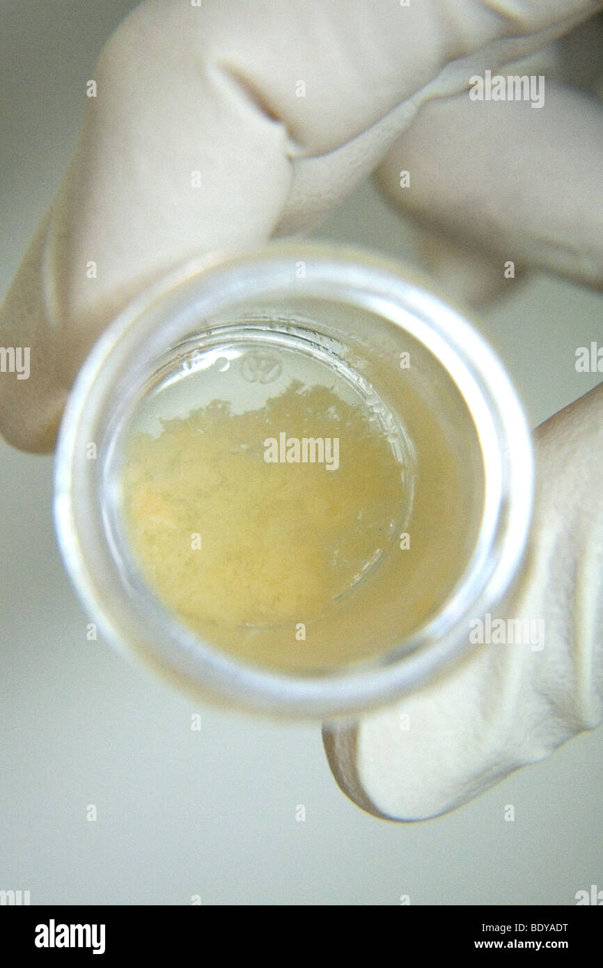 Stem cells hi-res stock photography and images - Alamy