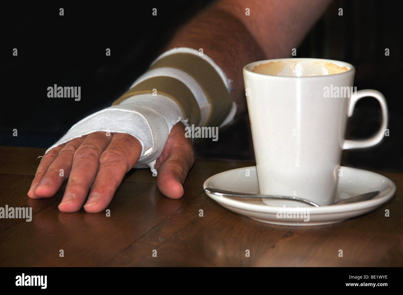 plaster, hand, wrist, injury, coffee, mug, table Stock Photo - Alamy