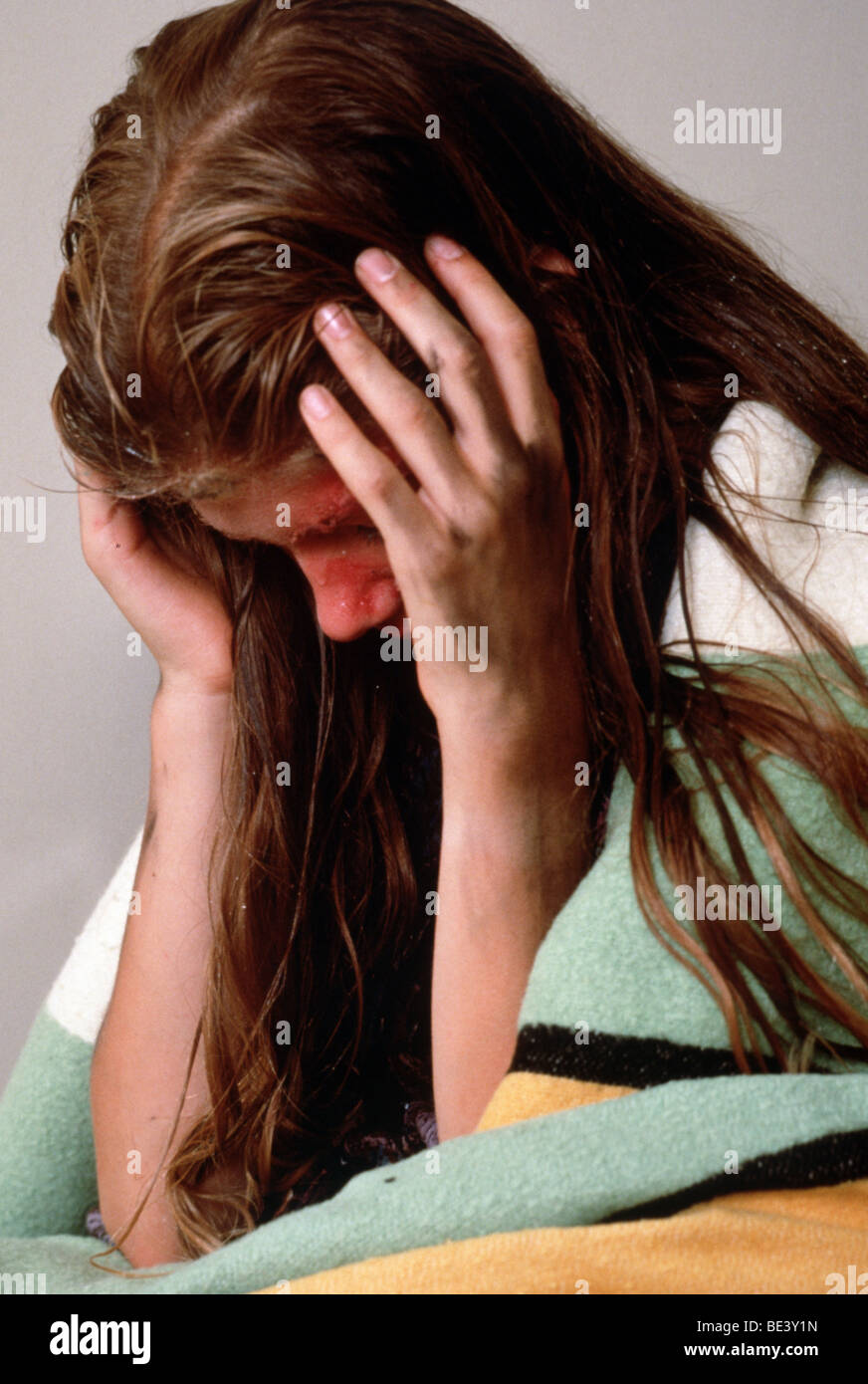 Burn Victim Child High Resolution Stock Photography and Images - Alamy