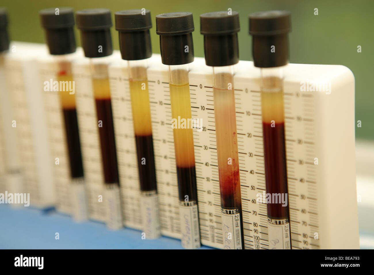 Test tubes with blood Stock Photo - Alamy