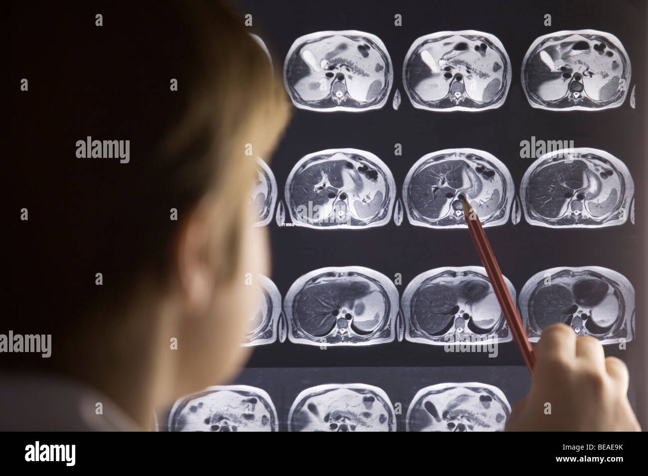 A doctor studying a MRI scan Stock Photo - Alamy