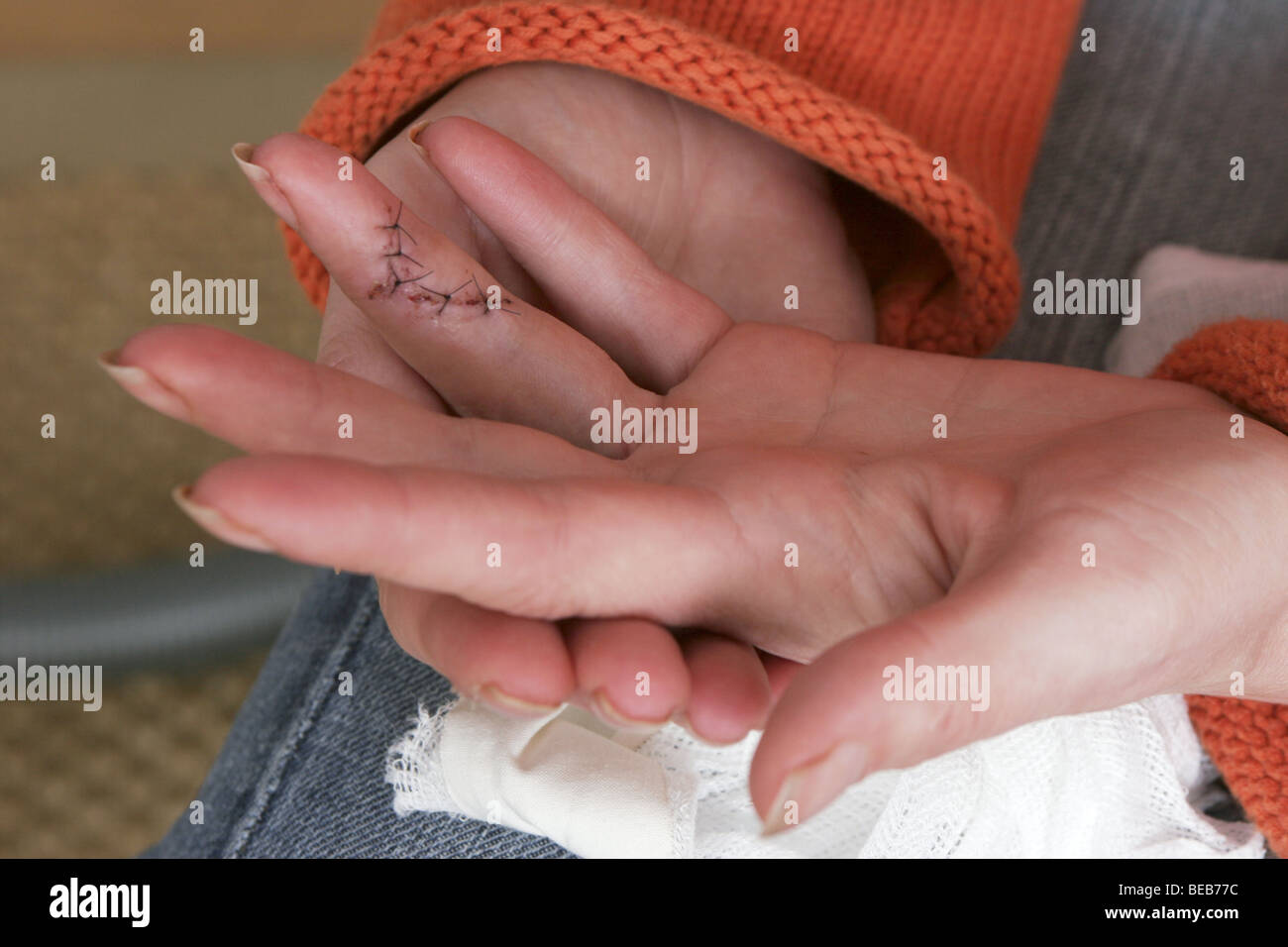 Closed wound hi-res stock photography and images - Alamy