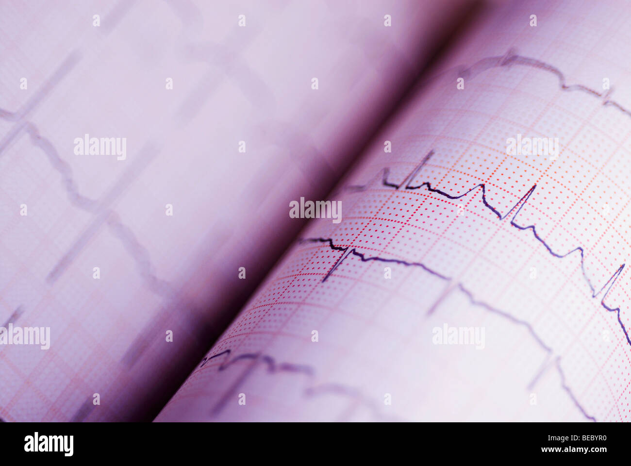 Close-up of an ECG report Stock Photo - Alamy