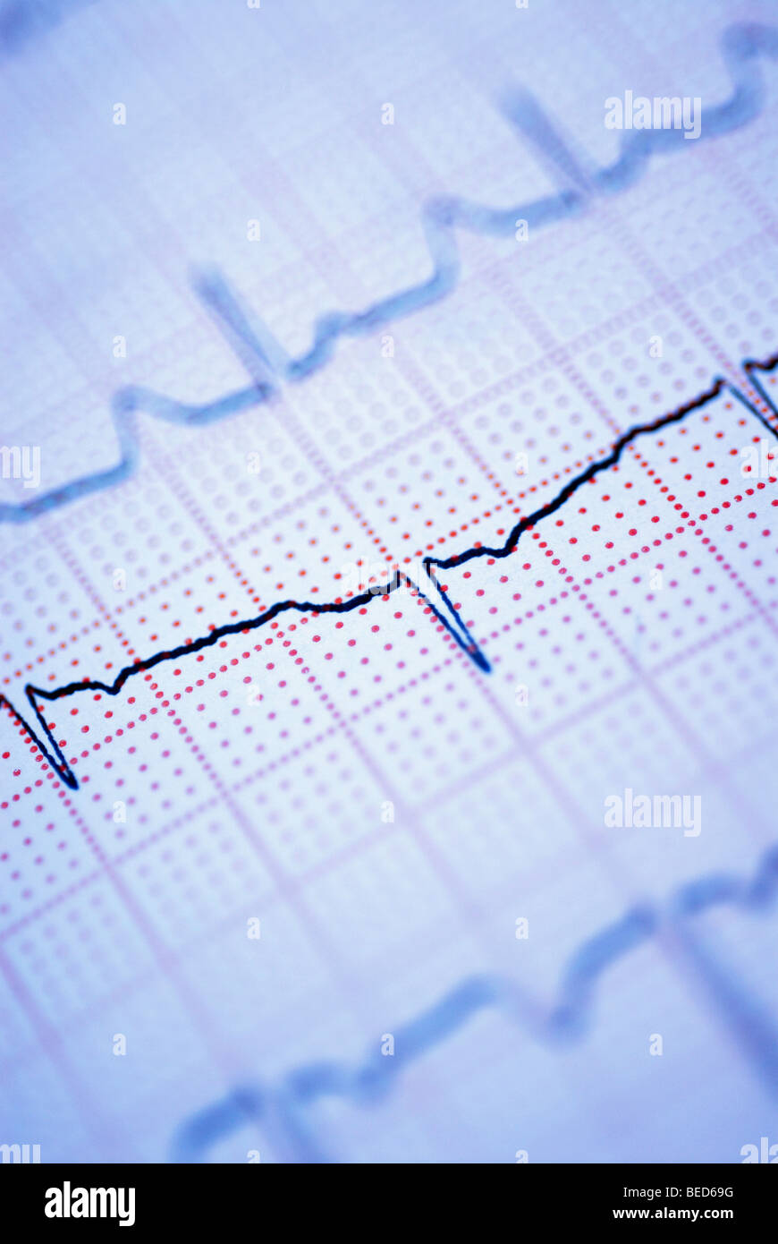 Electro cardiogram hi-res stock photography and images - Alamy