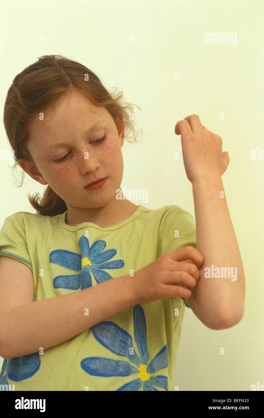 Girl scratching skin hi-res stock photography and images - Alamy
