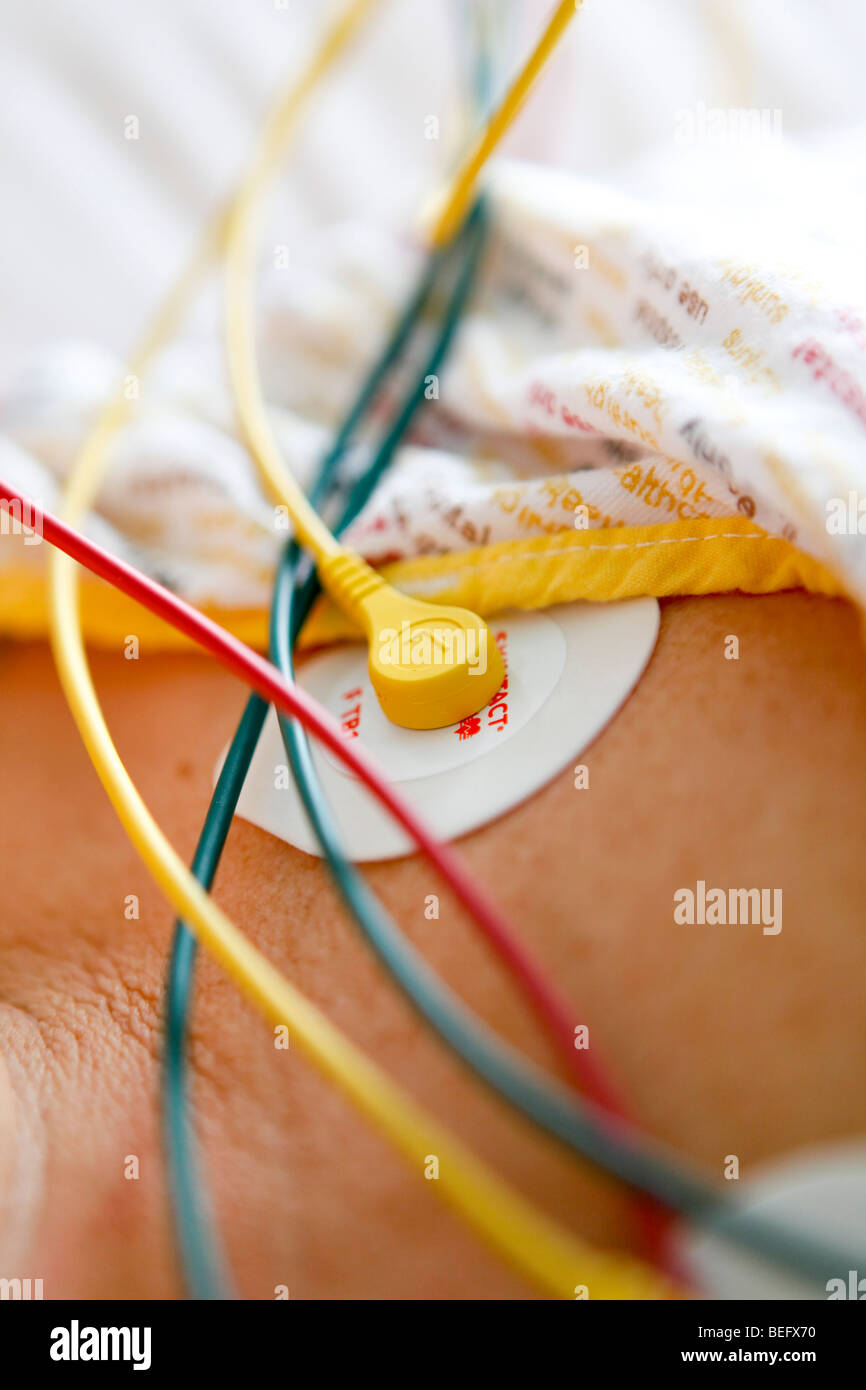 Chest monitoring cables hi-res stock photography and images - Alamy