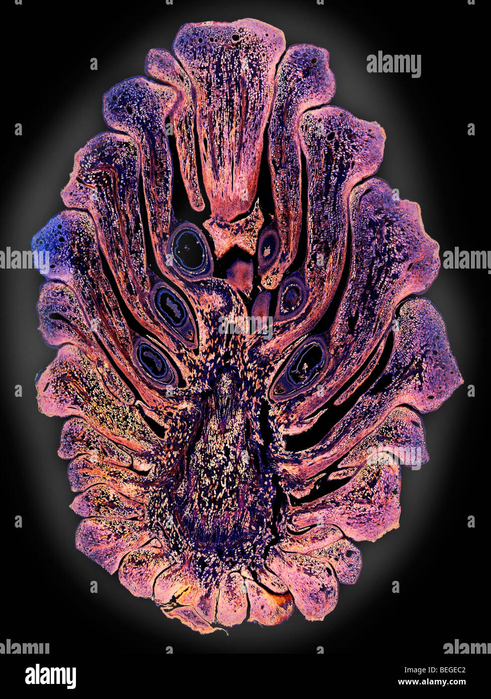 Pinus Female Cone Microscopic View