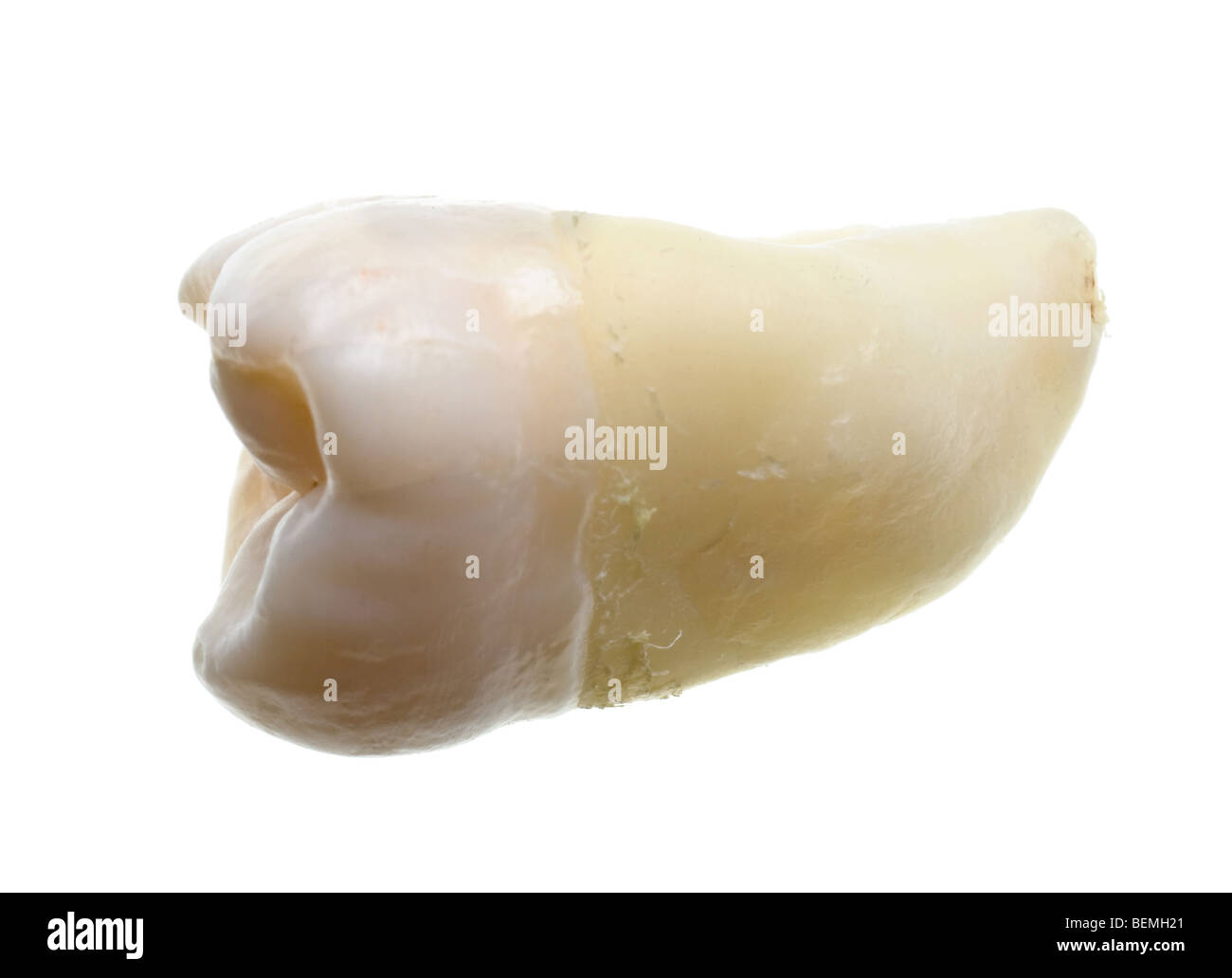 extracted wisdom tooth with roots isolated on white Stock Photo - Alamy