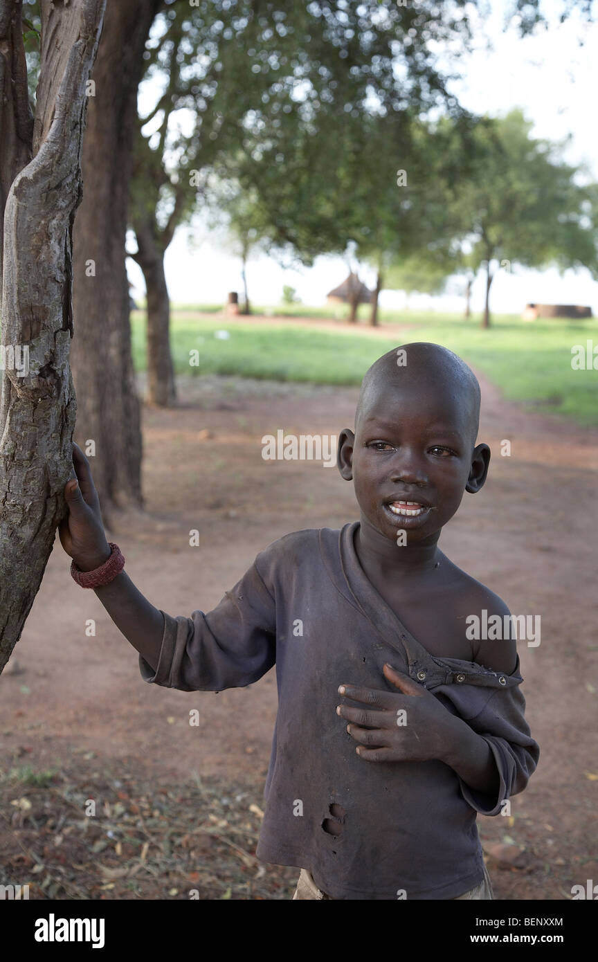 Leprosy child hi-res stock photography and images - Alamy