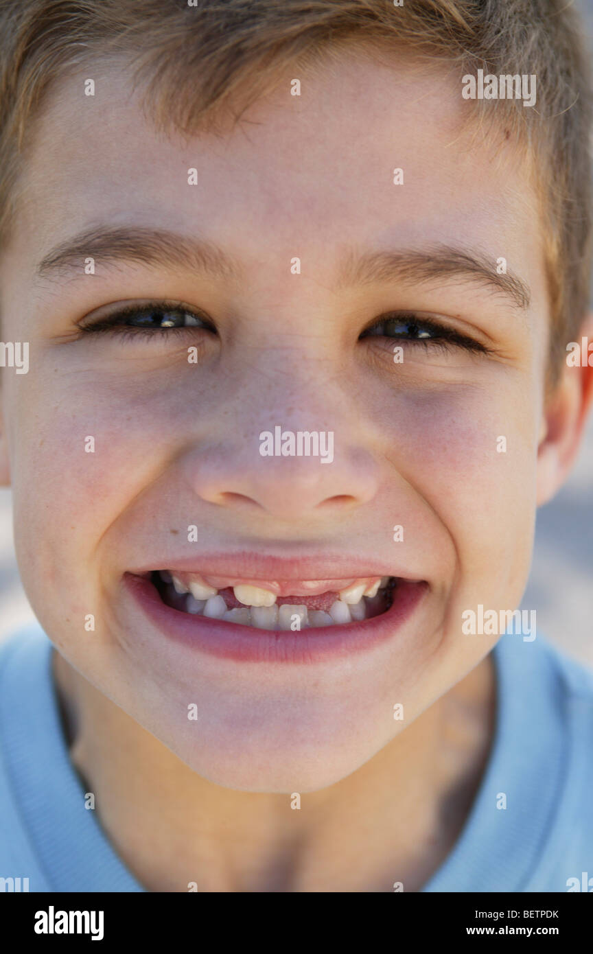 close-up portrait of a young boy who is missing some teeth Stock Photo ...