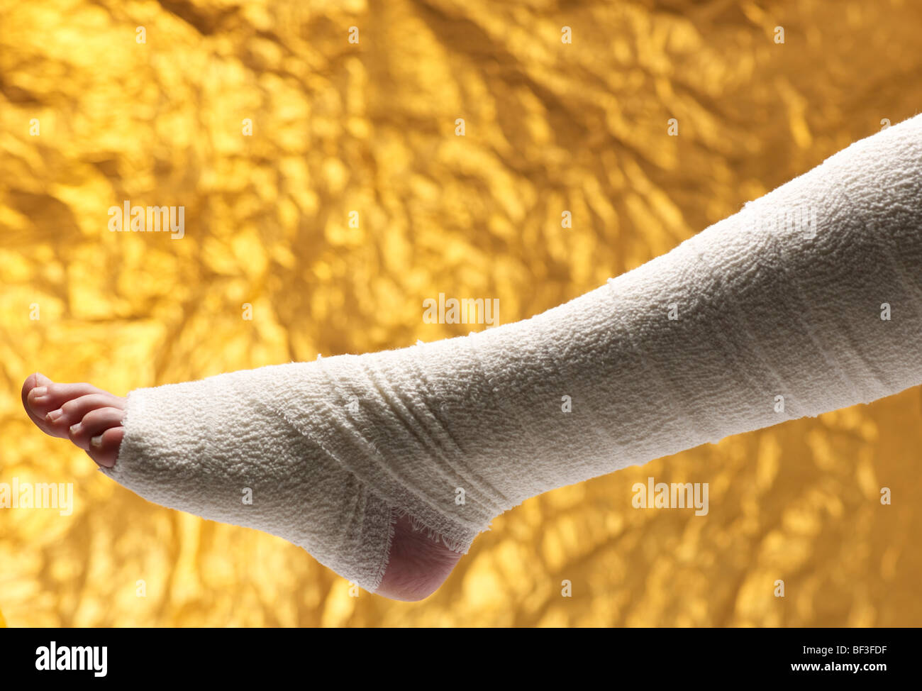 bandaged foot and lower leg Stock Photo - Alamy