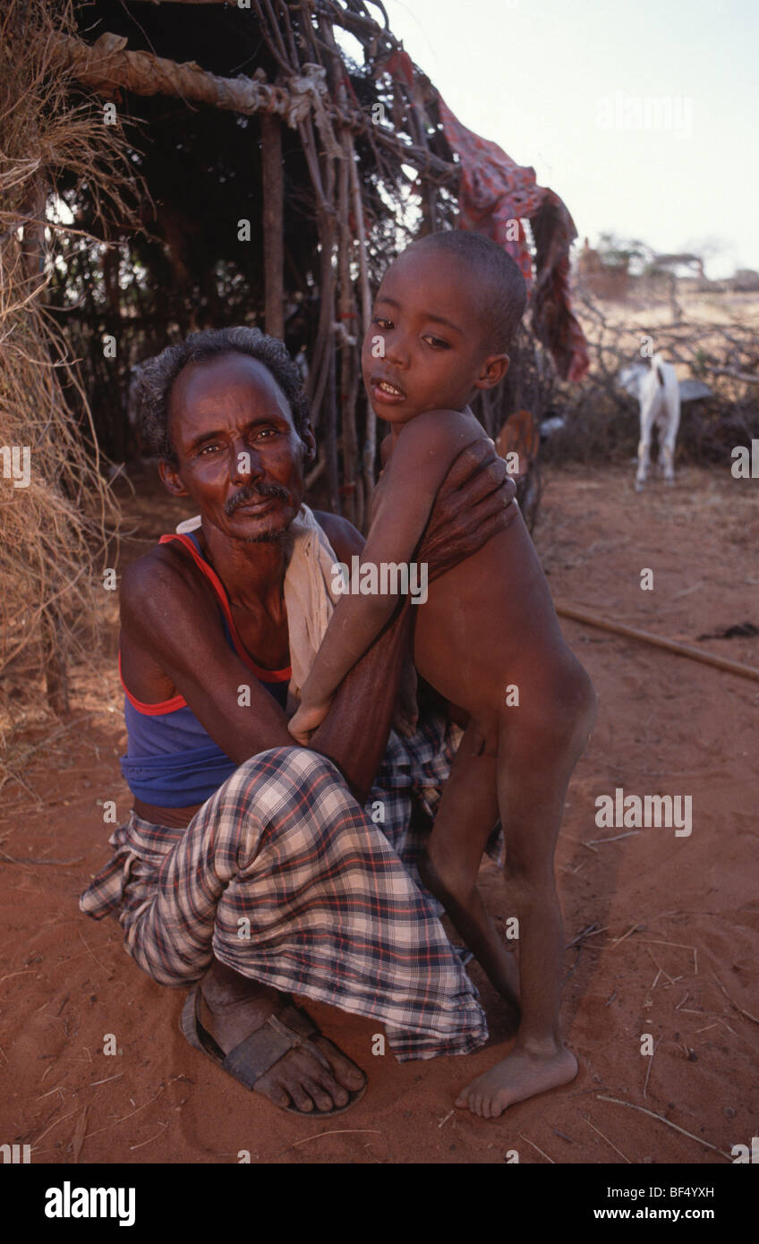 Starve child hi-res stock photography and images - Alamy