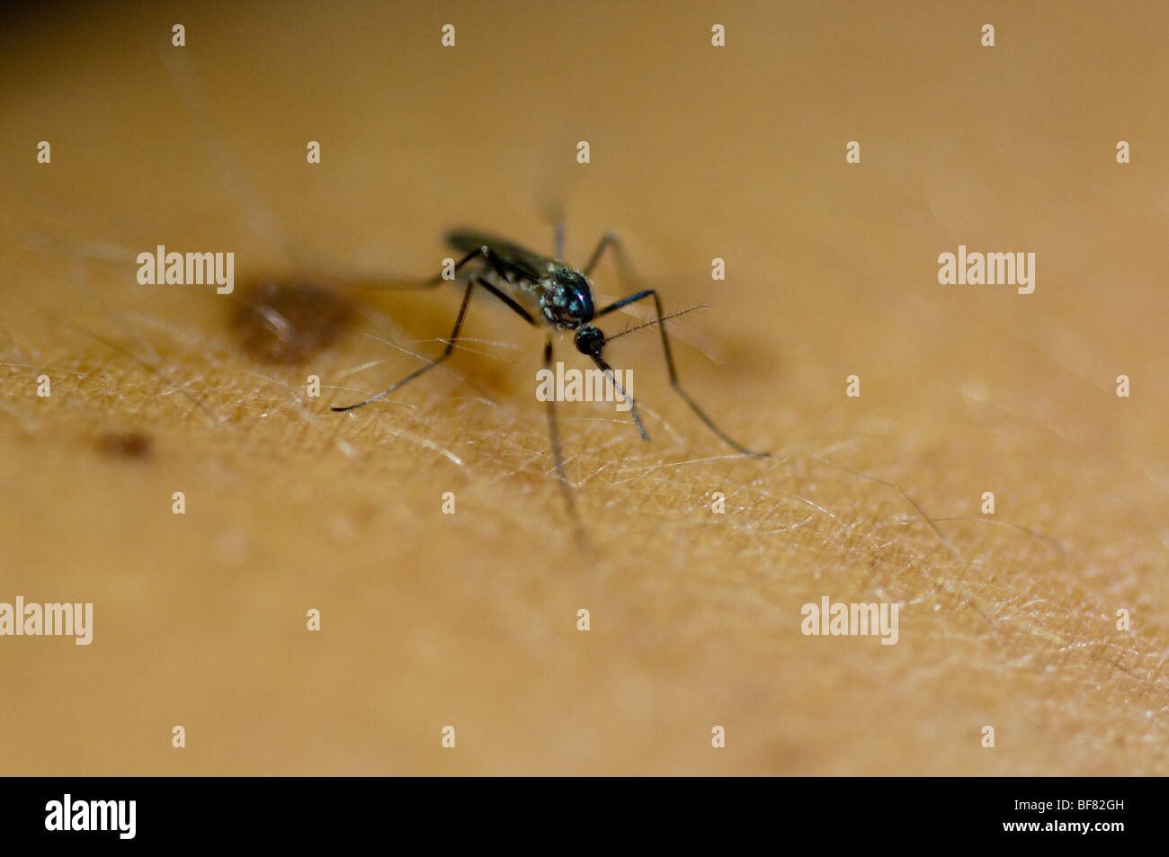 Insect bite skin hi-res stock photography and images - Alamy