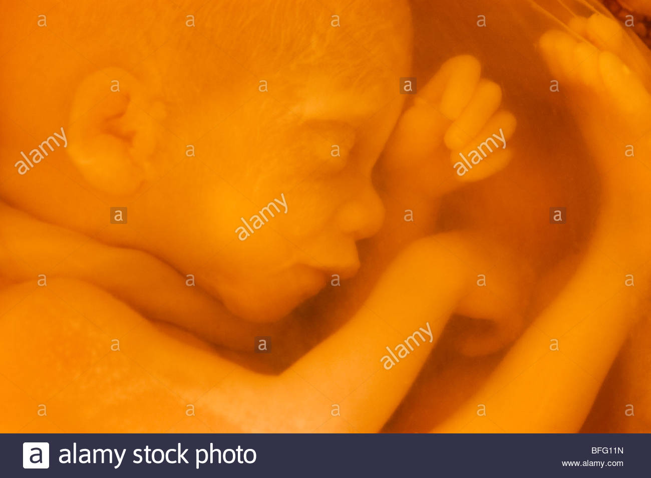 Animal Fetus Stock Photos & Animal Fetus Stock Images - Alamy