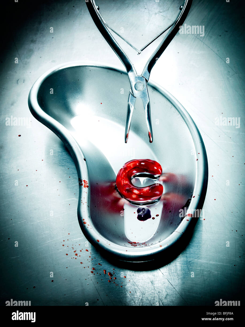 Tumor removed hi-res stock photography and images - Alamy