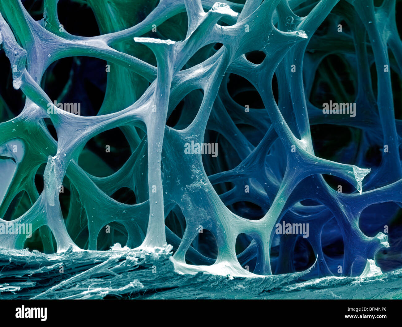 High scale magnifications hi-res stock photography and images - Alamy