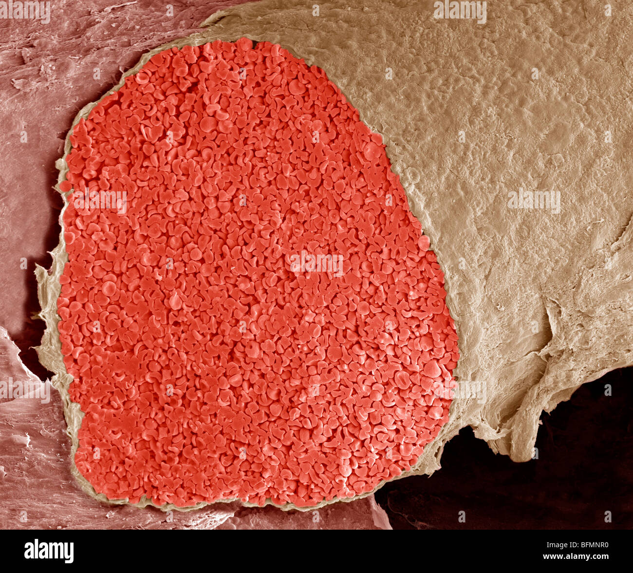 Foetal vein, SEM Stock Photo - Alamy