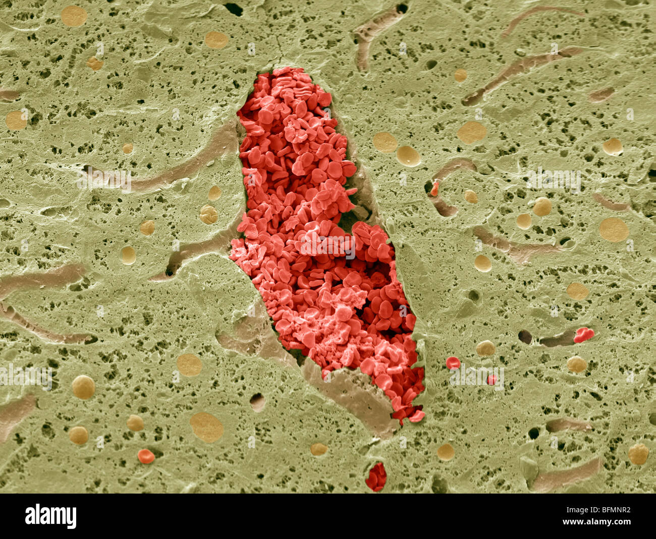 Liver vein sem hi-res stock photography and images - Alamy