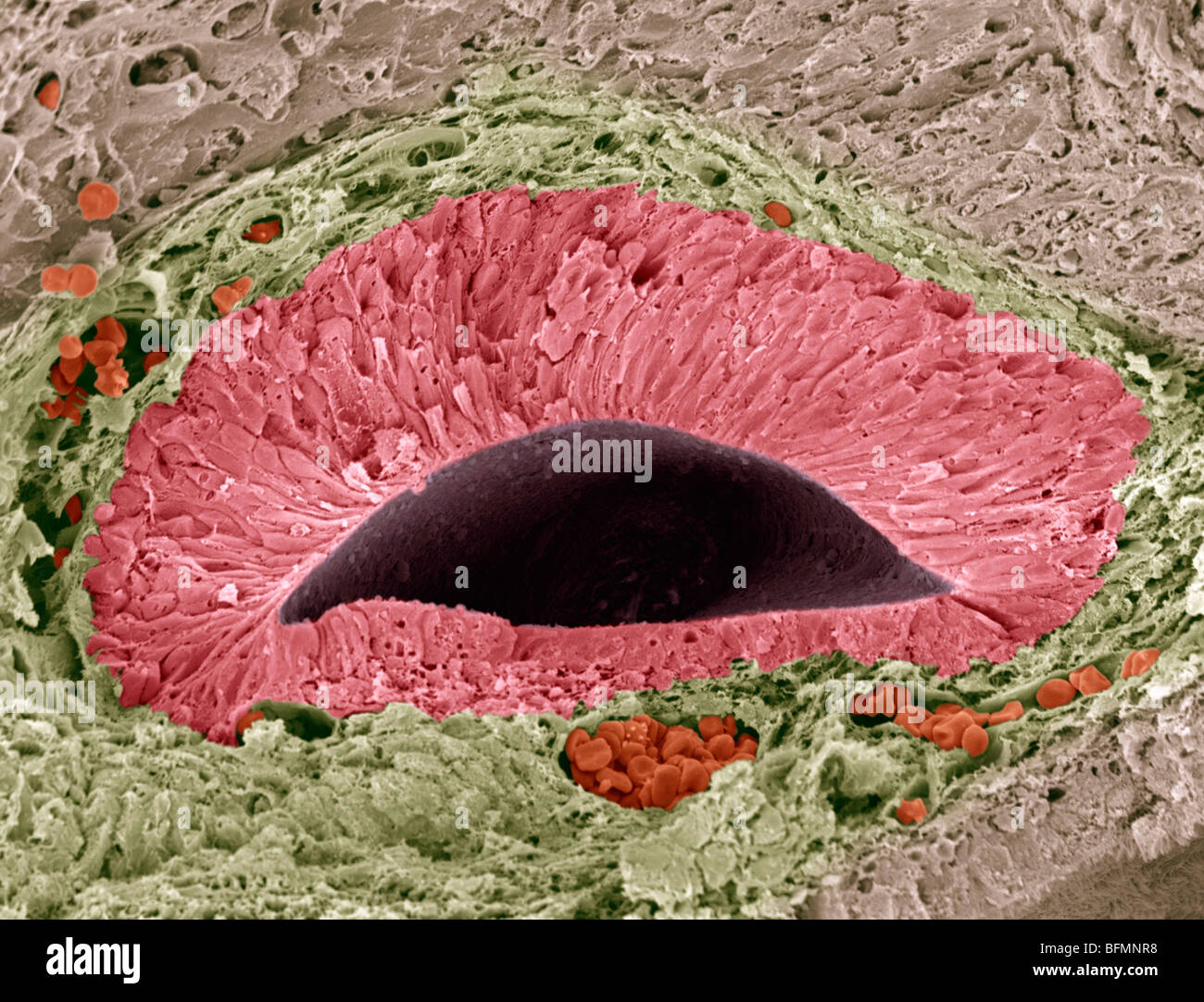 Foetal sense organ, SEM Stock Photo - Alamy