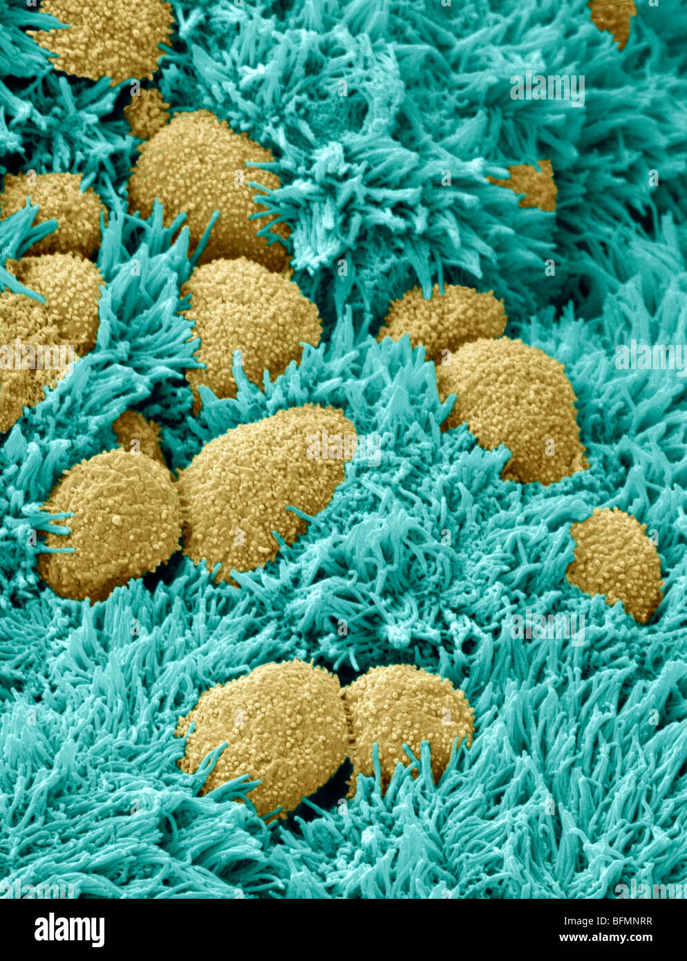 Fallopian tube cells, SEM Stock Photo - Alamy