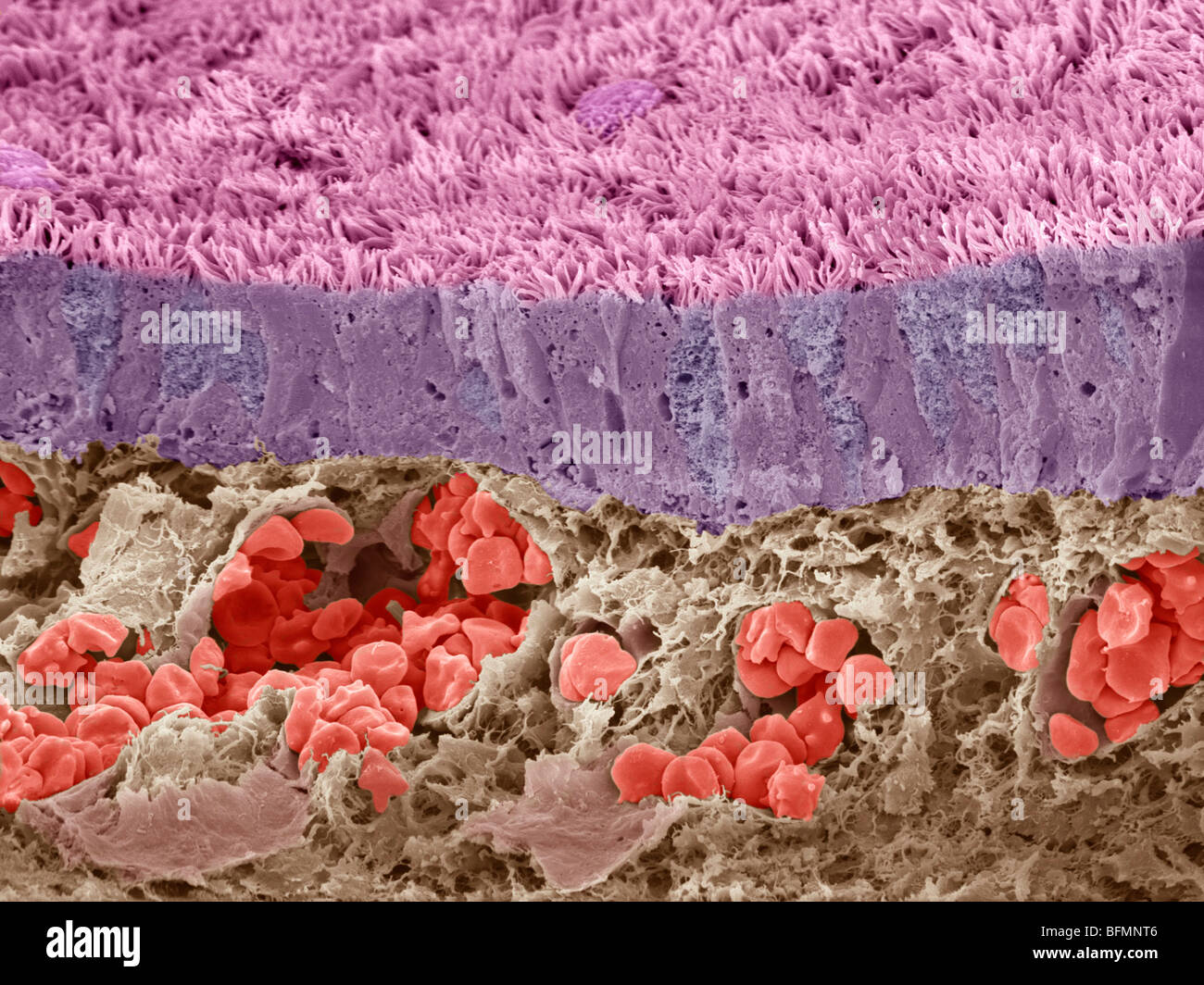 Lamina Propria Trachea