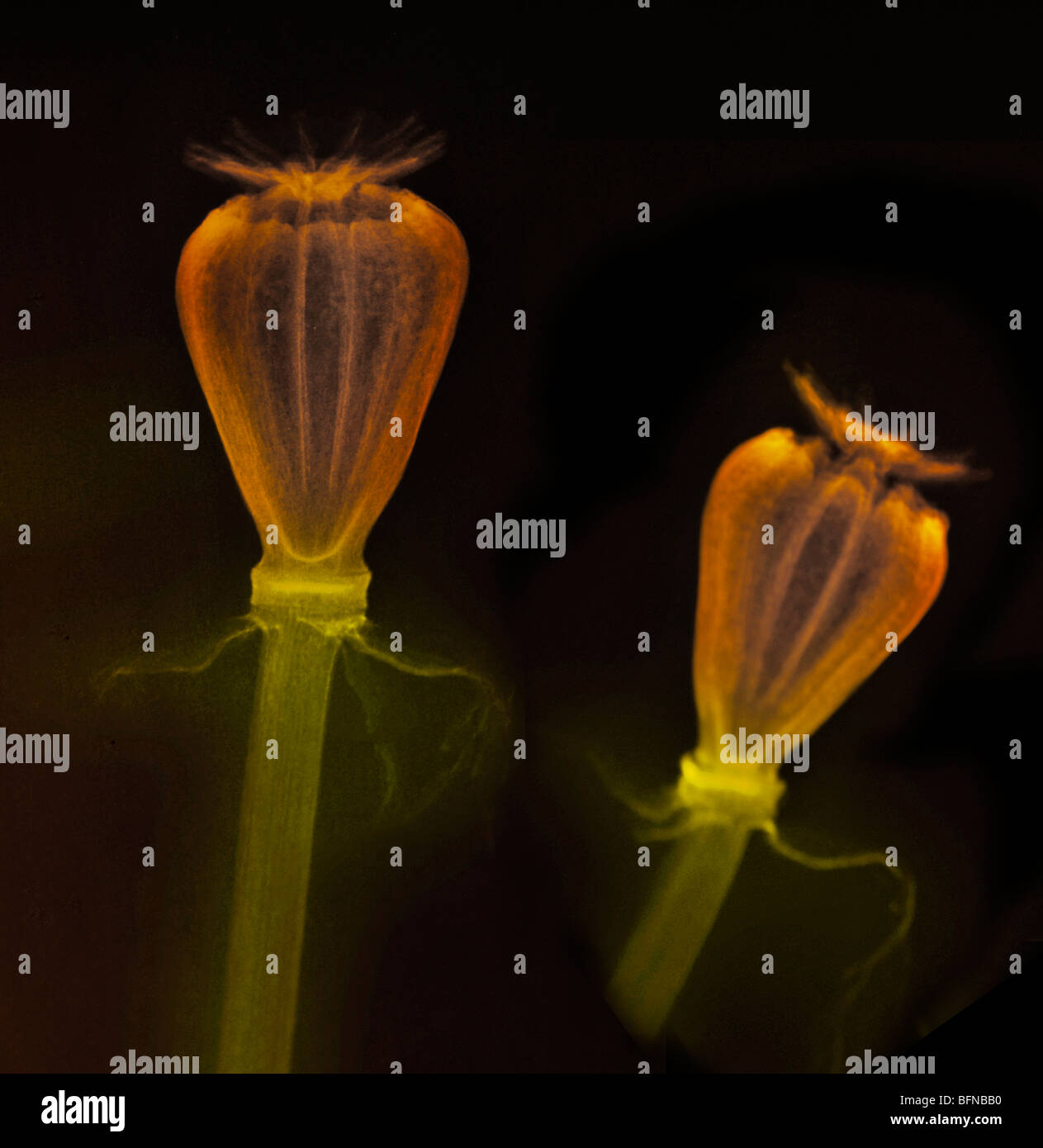 colorized x-ray image of poppy seed capsules Stock Photo - Alamy
