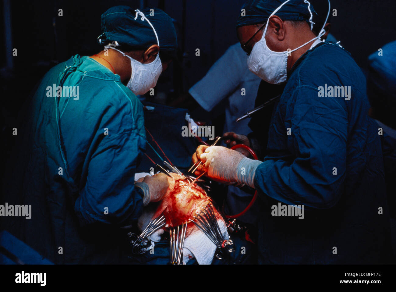 Open heart surgery ; India ; asia Stock Photo - Alamy
