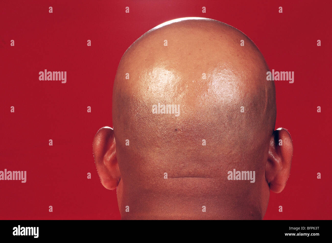 Scalp indian hi-res stock photography and images - Alamy