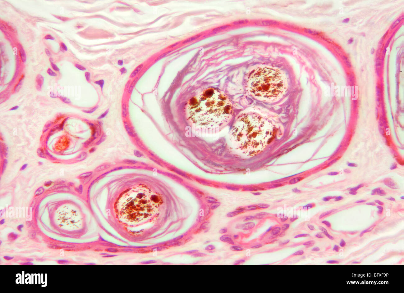 Hair follicle microscope hi-res stock photography and images - Alamy
