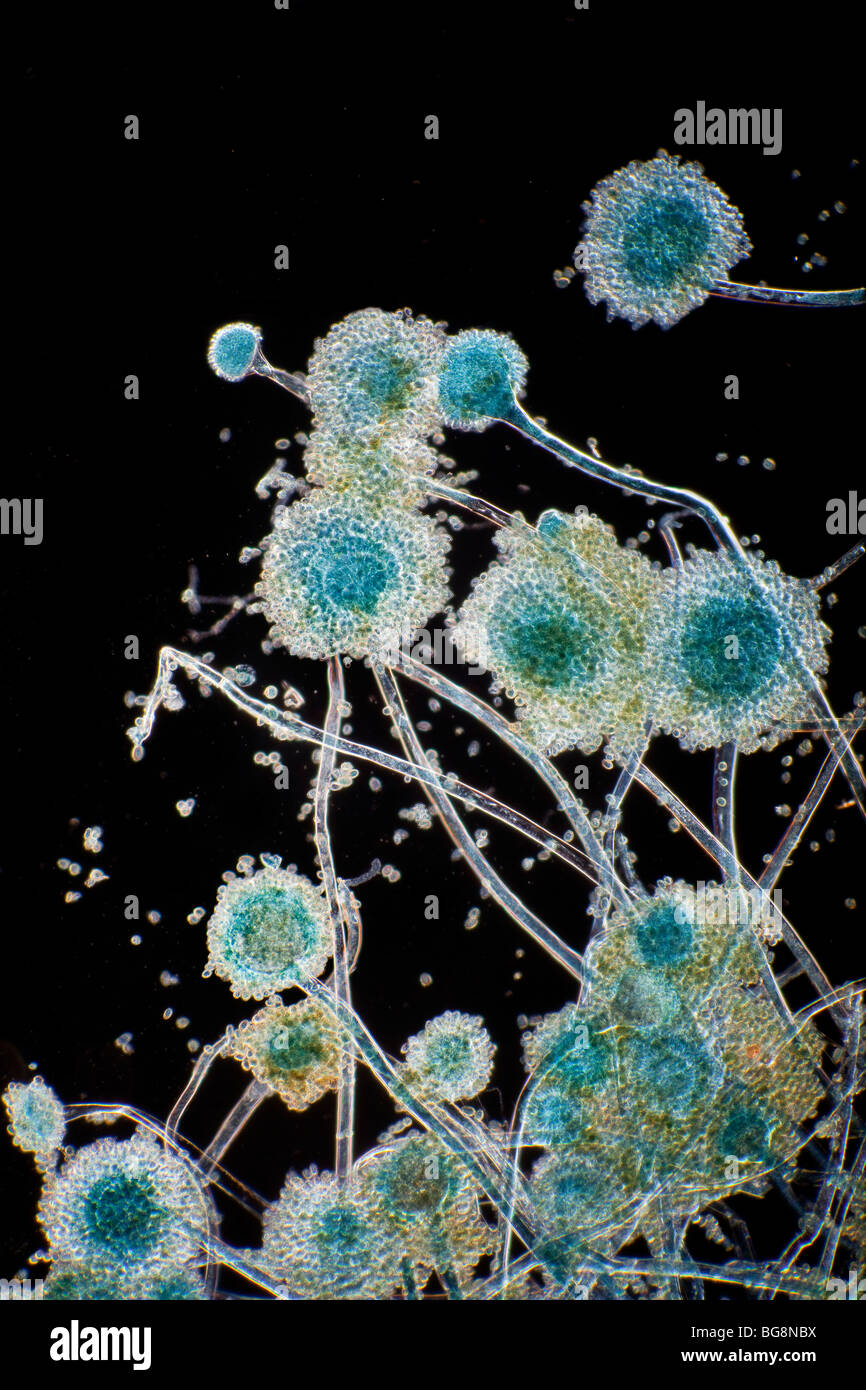 Aspergillus Fungus High Resolution Stock Photography and Images - Alamy