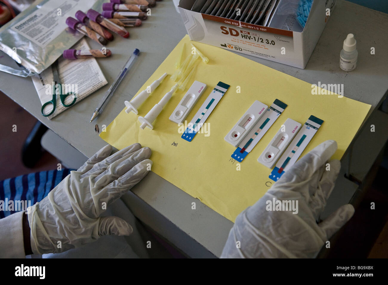 Hiv rapid test hi-res stock photography and images - Alamy
