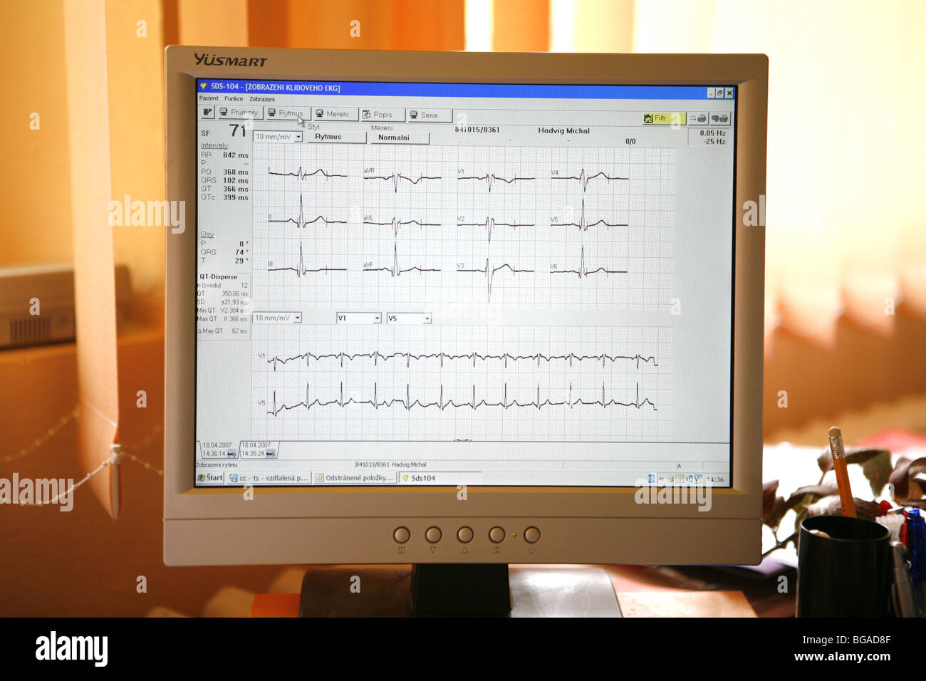 Ecg snapshot hi-res stock photography and images - Alamy