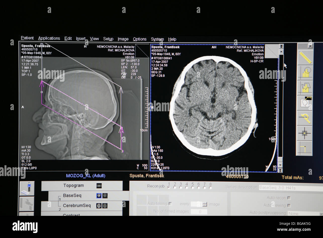 Examination of a CT snapshot Stock Photo - Alamy