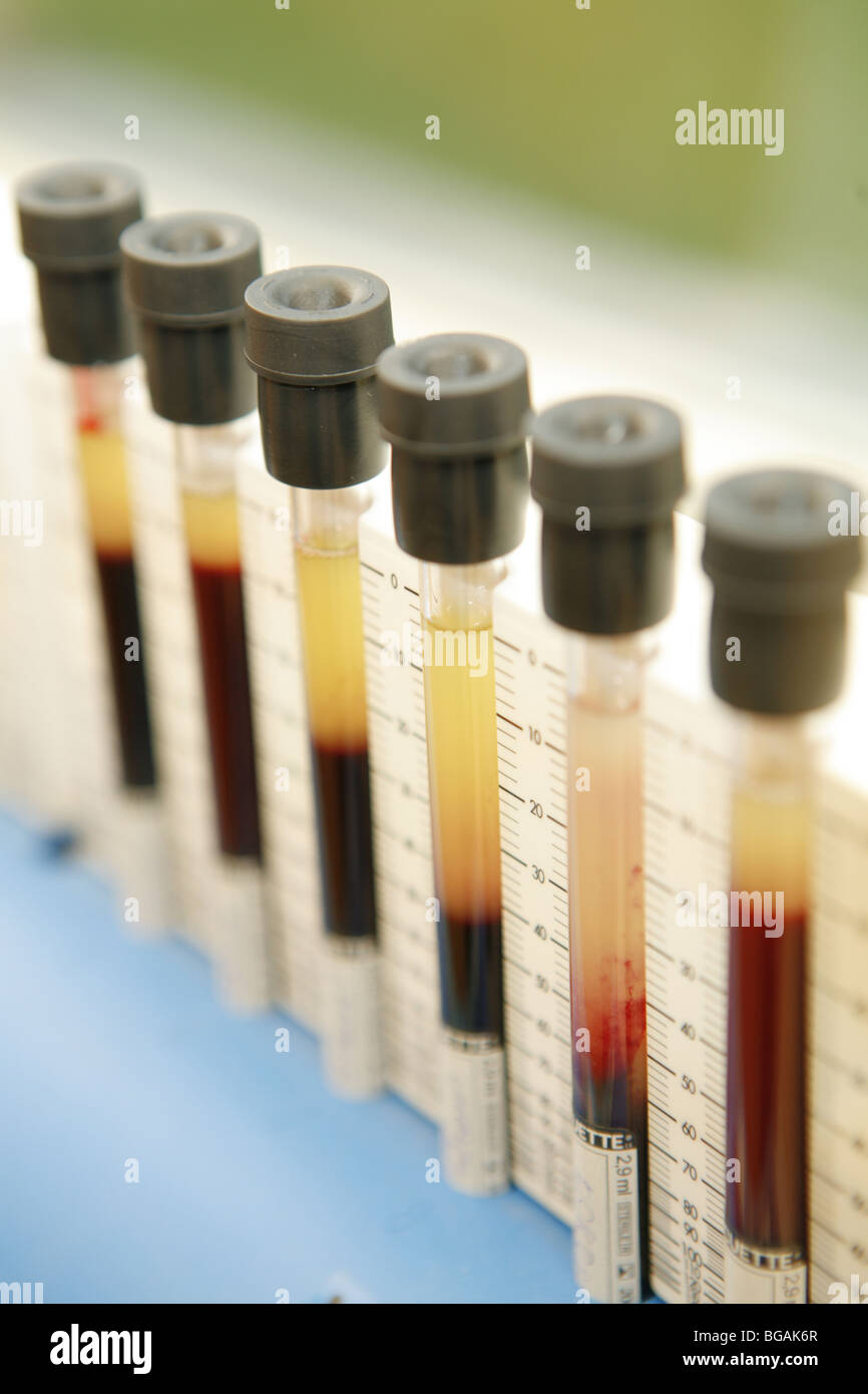 Blood samples in tubes Stock Photo - Alamy