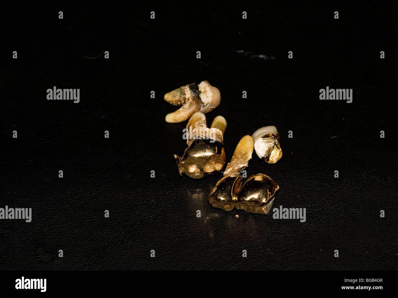 Man gold teeth hi-res stock photography and images - Alamy