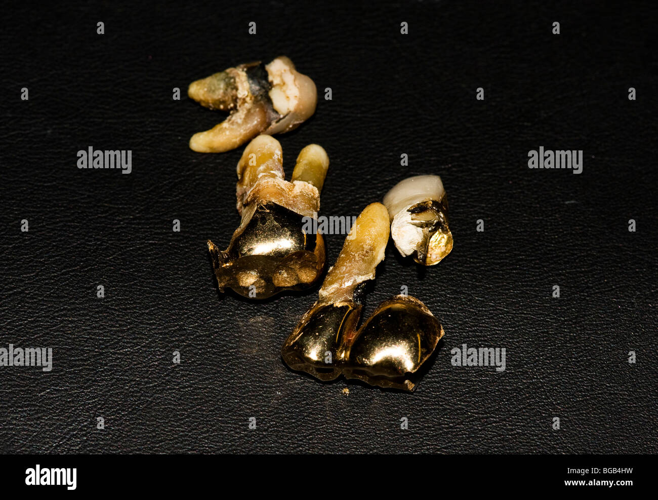 Man gold teeth hi-res stock photography and images - Alamy