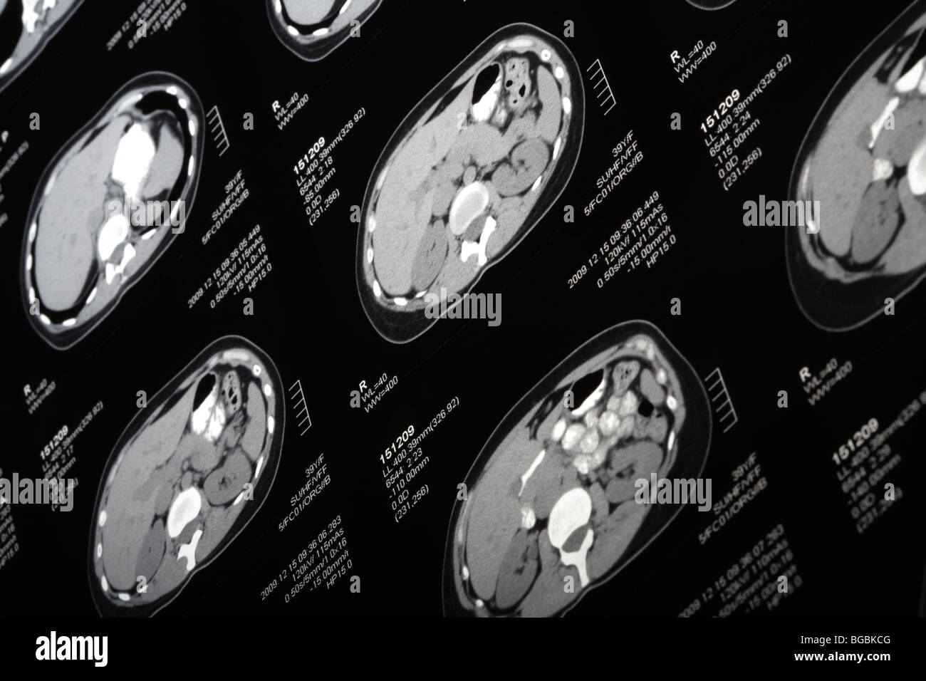 Mri scan body hi-res stock photography and images - Alamy
