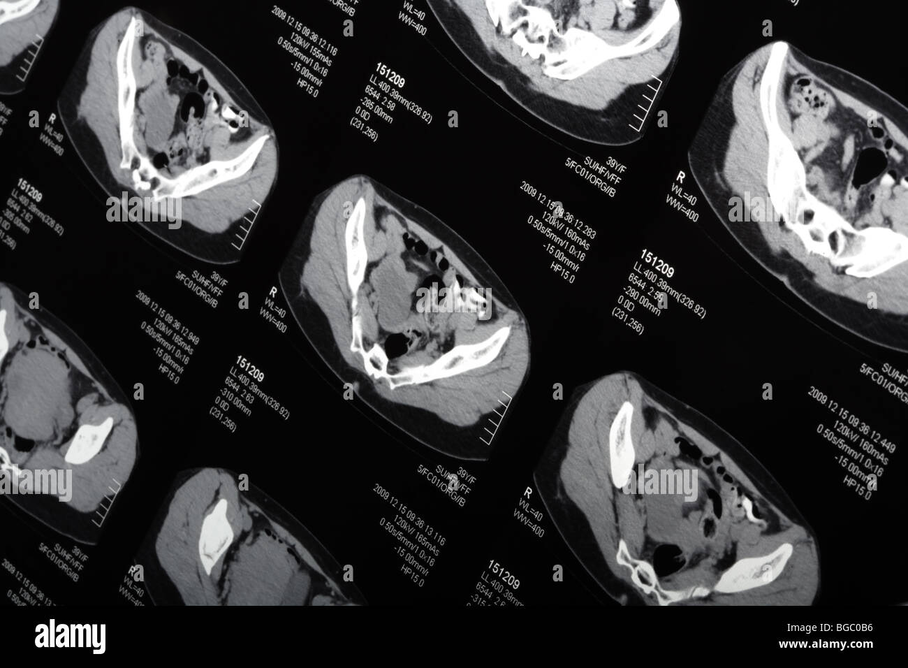 MRI scan close-up. Tilt view Stock Photo - Alamy