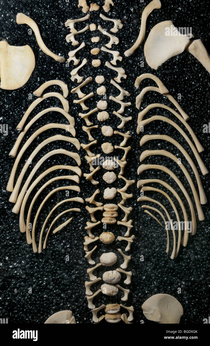 Disarticulated skeleton of a child showing vertebral column and ribs ...