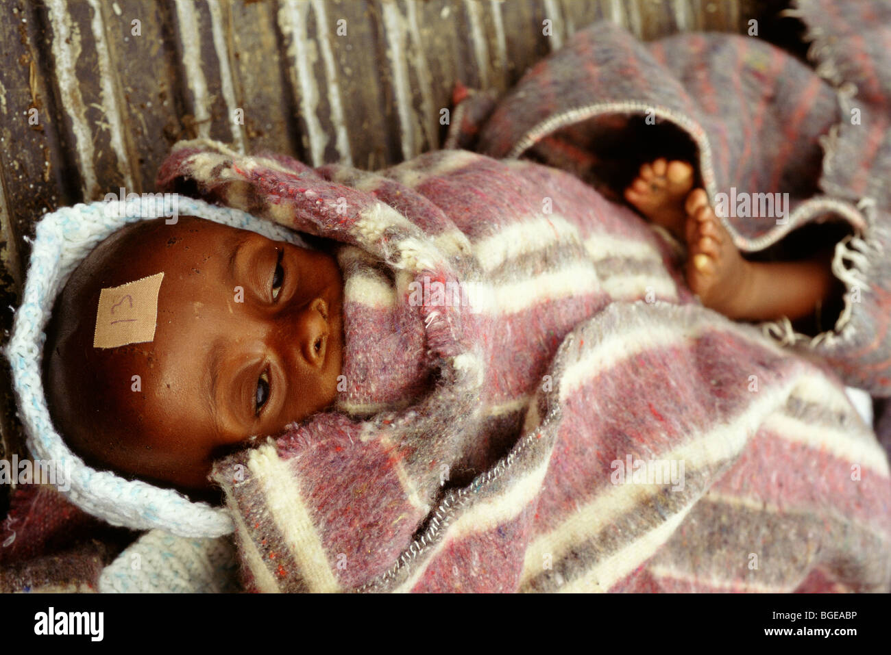 Kibimba Camp, Goma, Aug 1994. This child in the camp's orphanage has ...