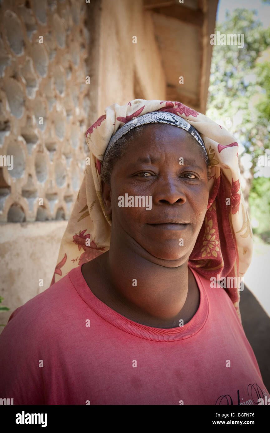 Goiter Woman High Resolution Stock Photography and Images - Alamy