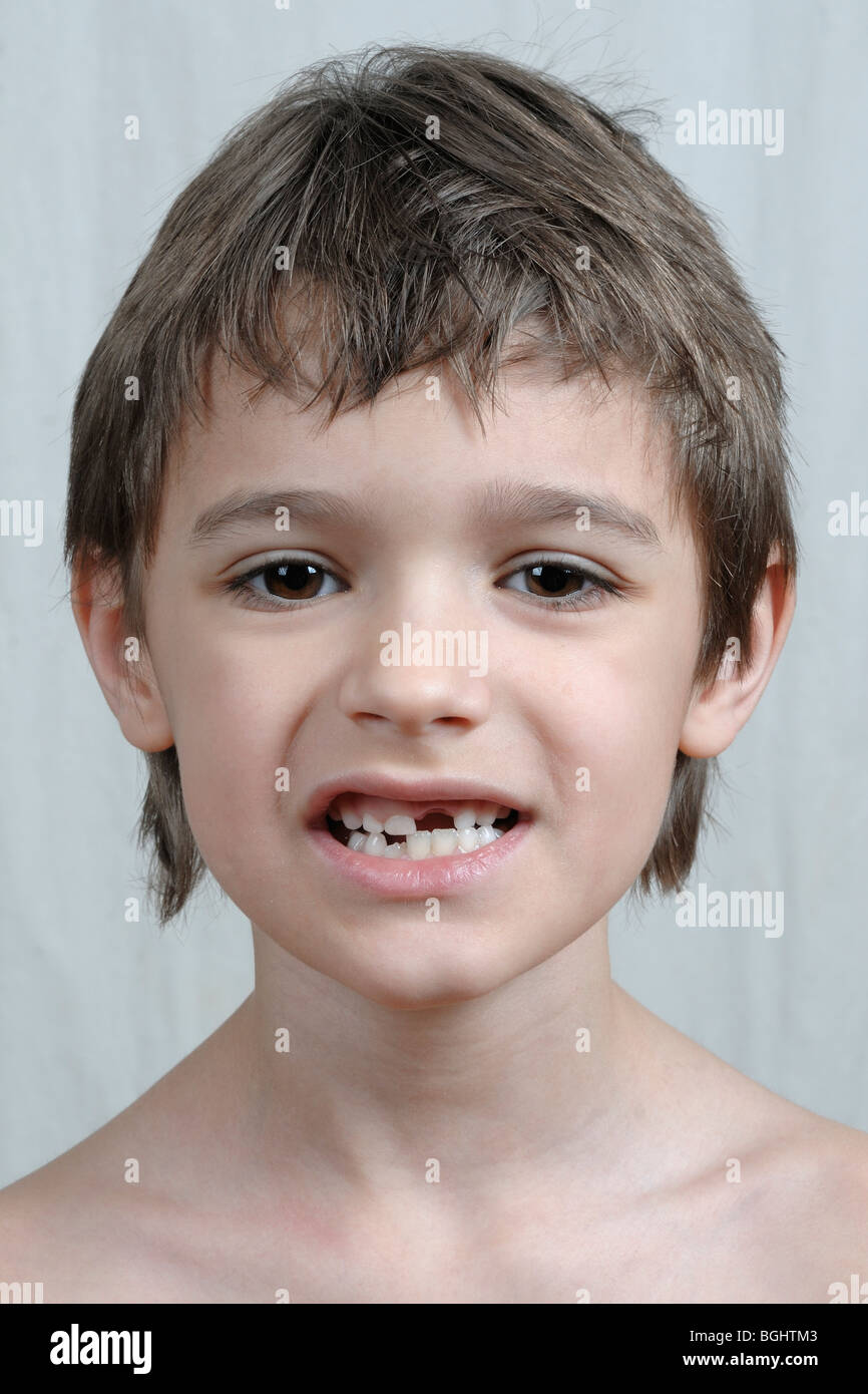 A young boy without his two front teeth Stock Photo - Alamy