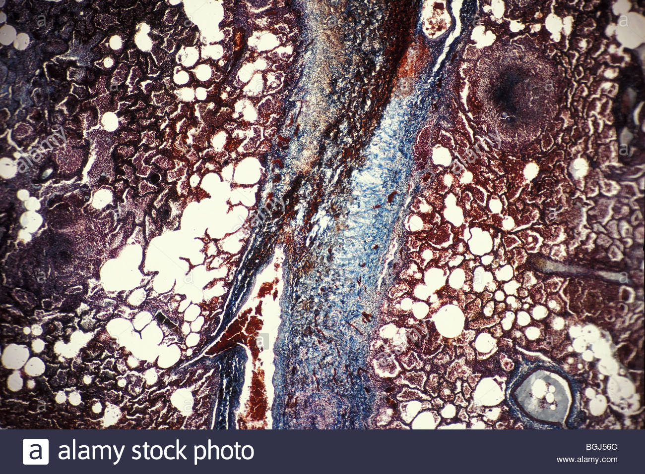 Miliary Stock Photos & Miliary Stock Images - Alamy