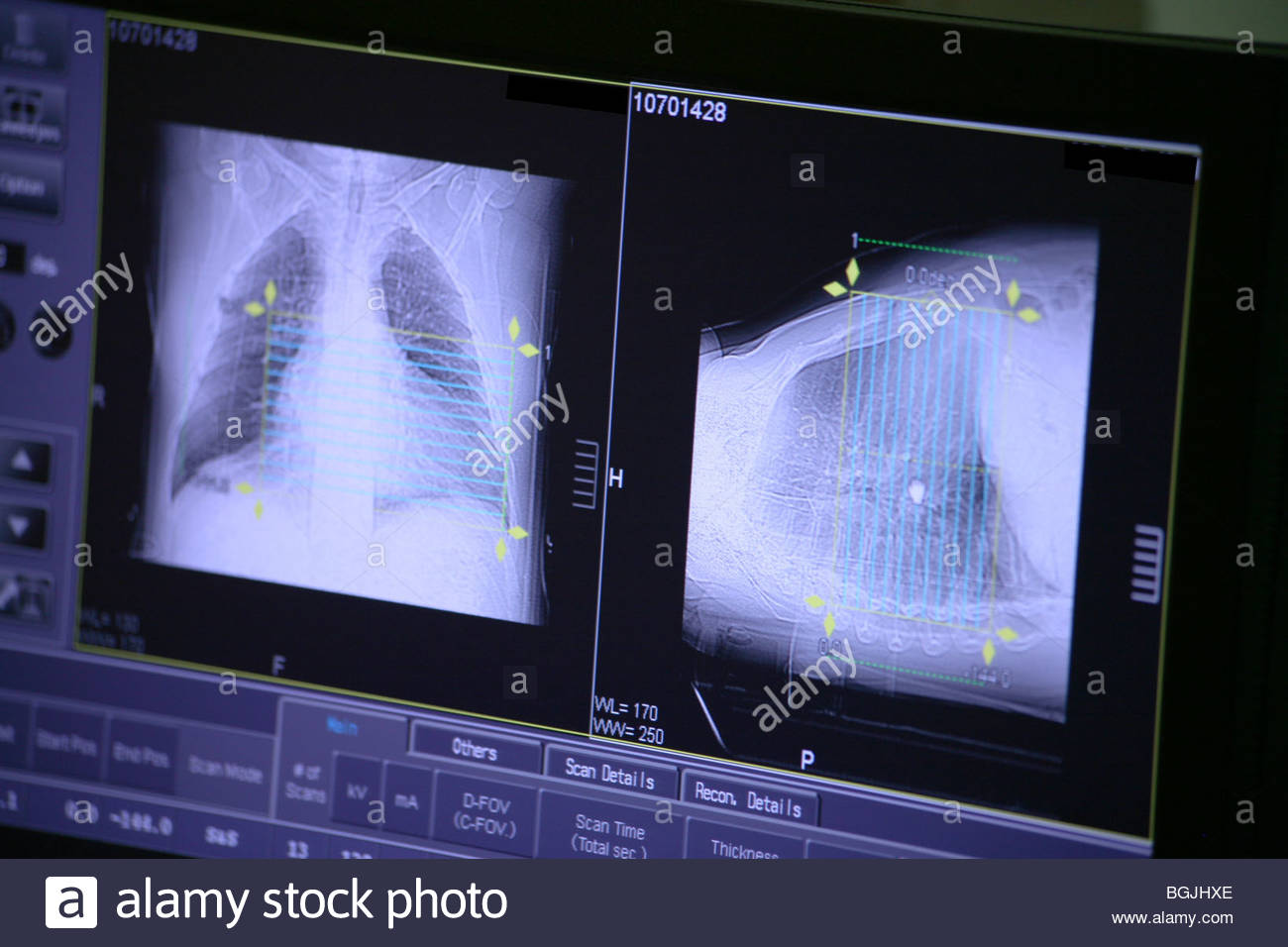 Body Scanner Stock Photos & Body Scanner Stock Images - Alamy