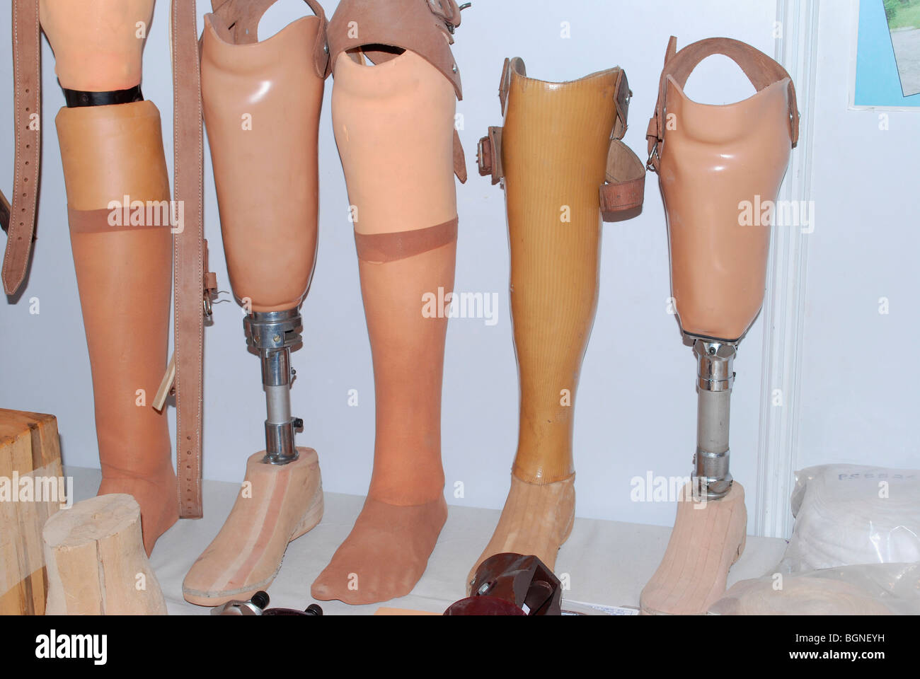 Types Of Prosthetic Legs Below Knee Online Retailers | prode ...